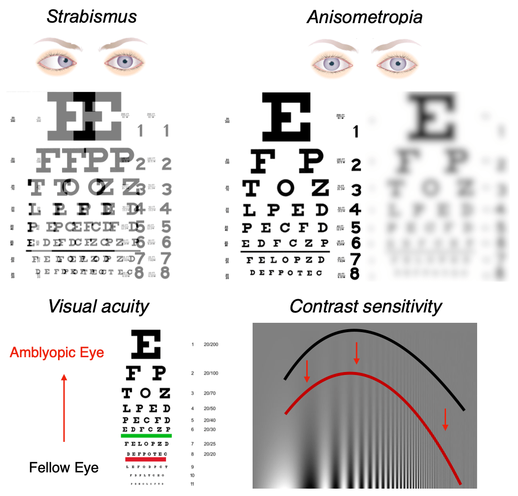 The Rokers Vision Laboratory | Psychology, New York University Abu Dhabi